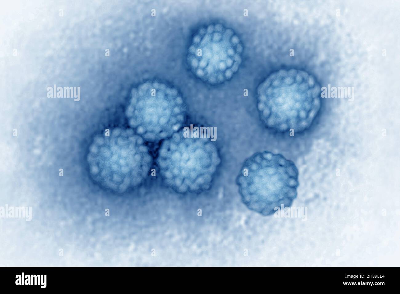 Human papillomavirus micrograph hi-res stock photography and images - Alamy