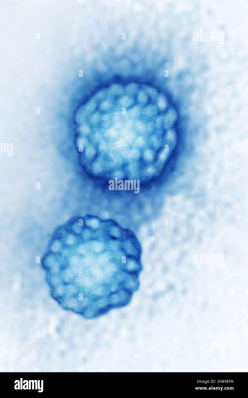 Human papillomavirus micrograph hi-res stock photography and images - Alamy