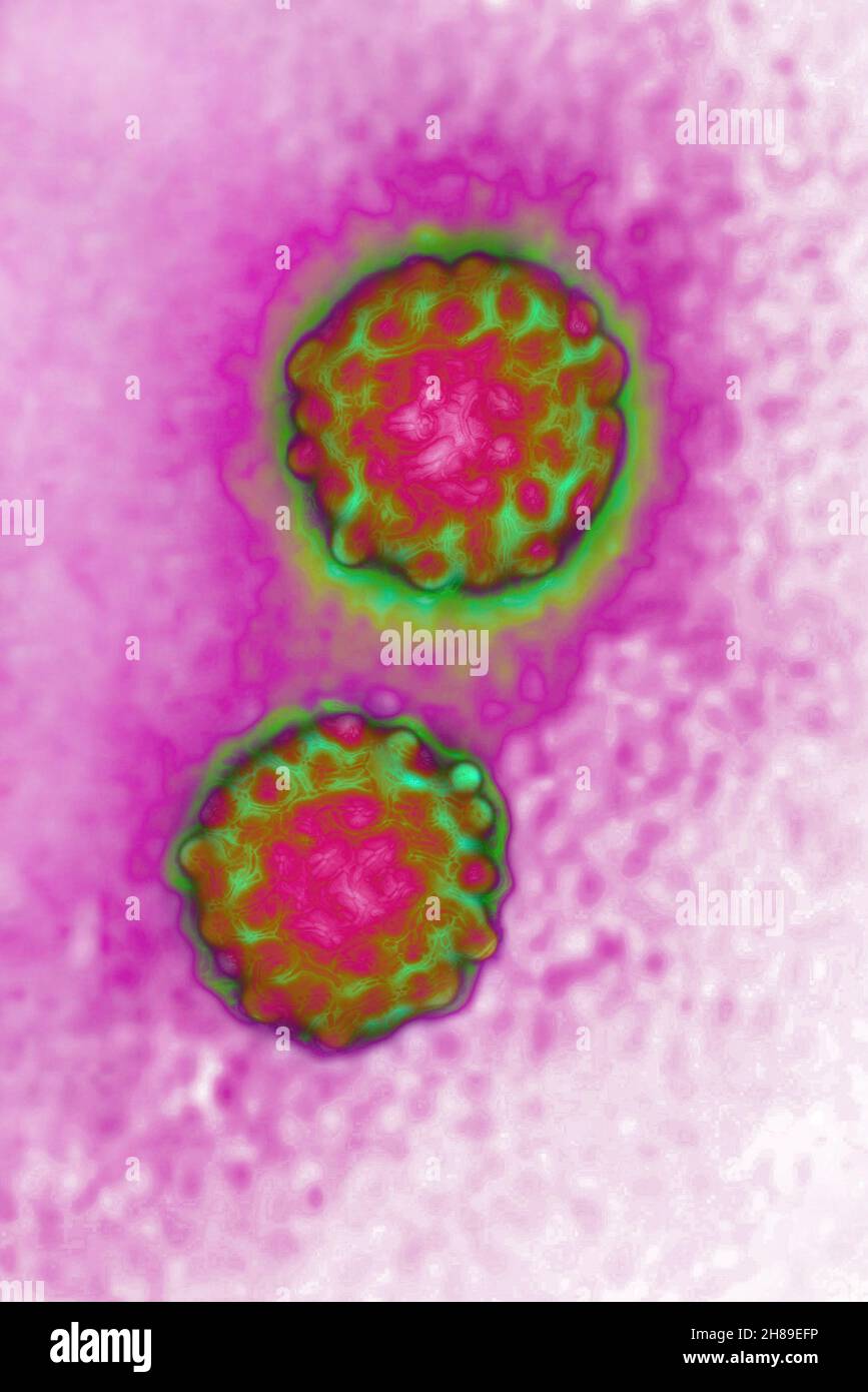 Human papillomavirus micrograph hi-res stock photography and images - Alamy