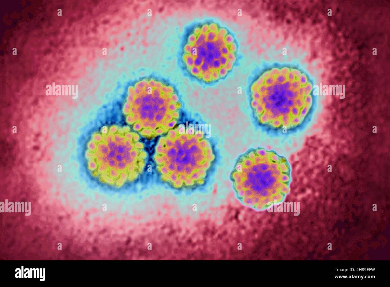 Human papillomavirus micrograph hi-res stock photography and images - Alamy