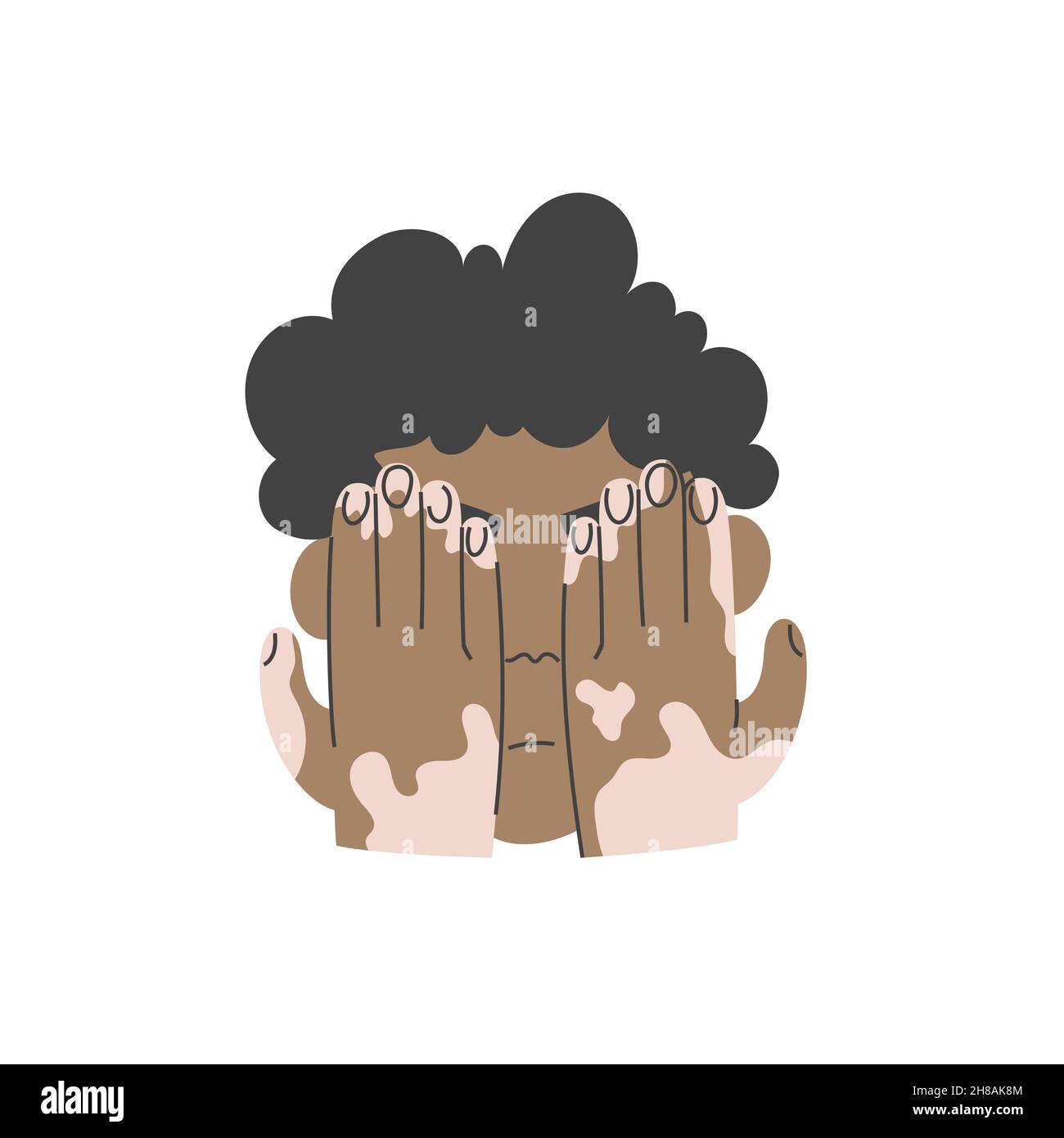 Boy with vitiligo hi-res stock photography and images - Alamy