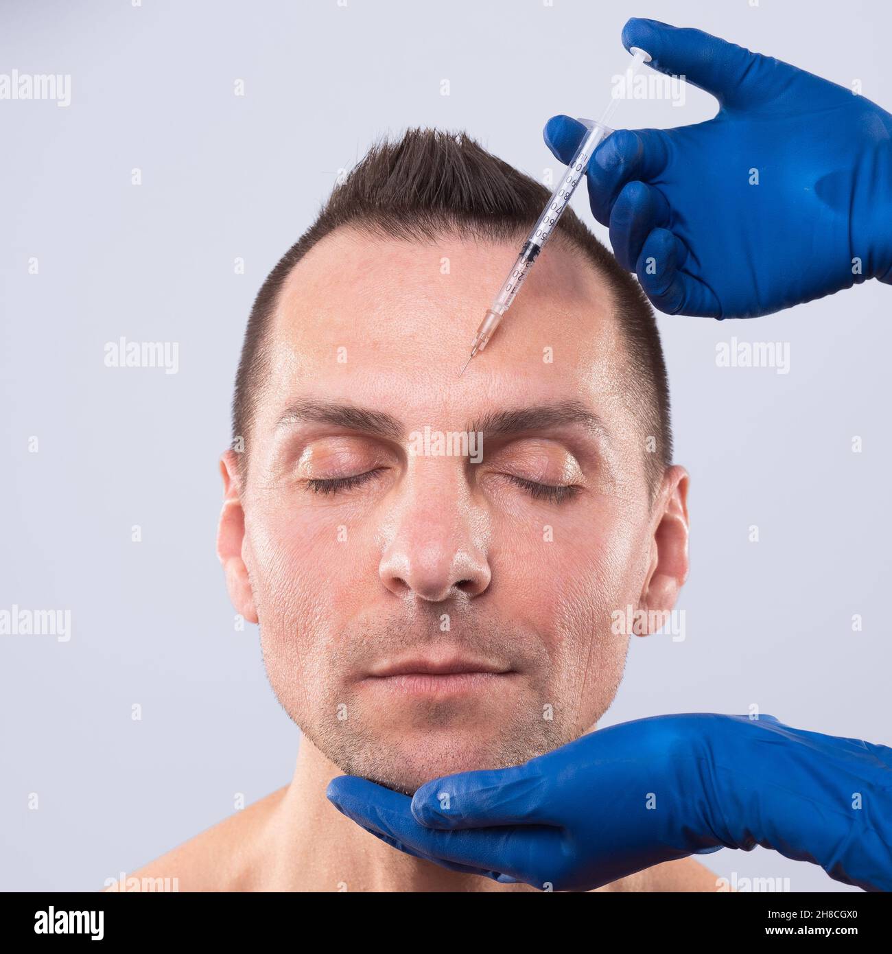 Botulinum Therapy. Close-up Of Person Hands Injecting Syringe With ...