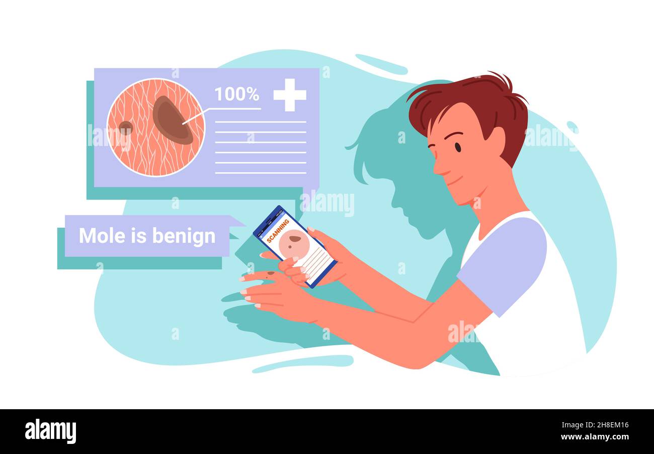 Man with mole test in smartphone app, using phone to identify benign or ...