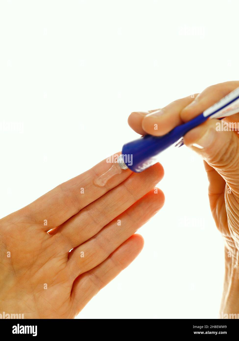 Applying gel with a tube to a finger Topical treatment concept Stock ...
