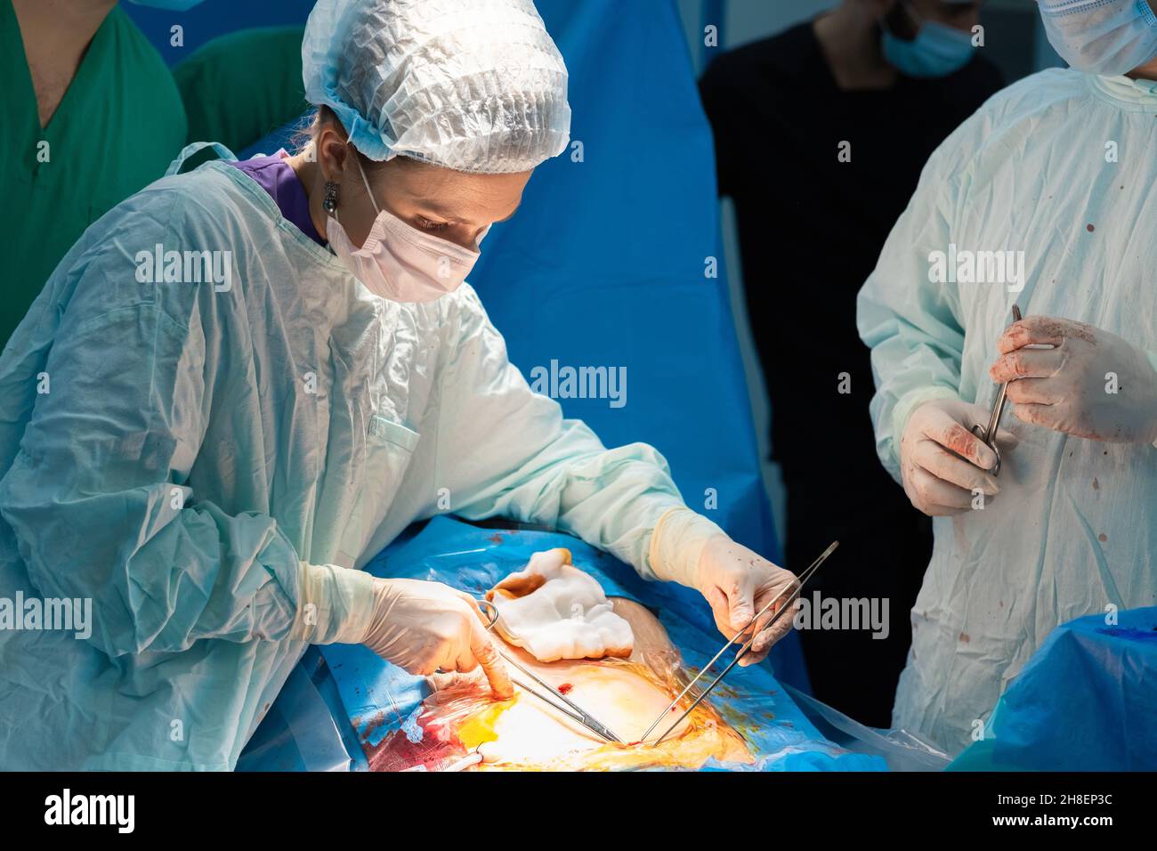 A woman surgeon performs a surgical operation on a patient's body. The ...