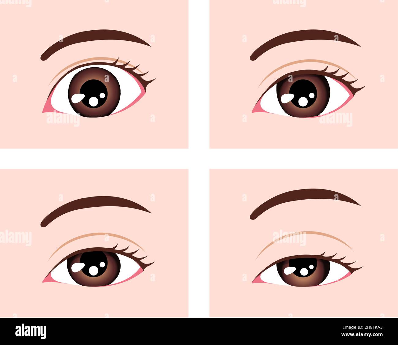 Eyelid ptosis Cut Out Stock Images & Pictures - Alamy