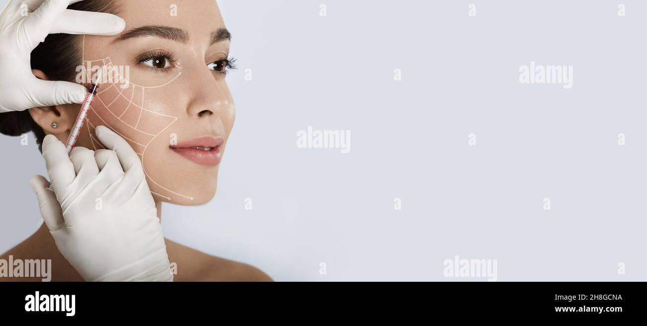 beauty injections, lifting lines on a woman's face, advertising of skin ...