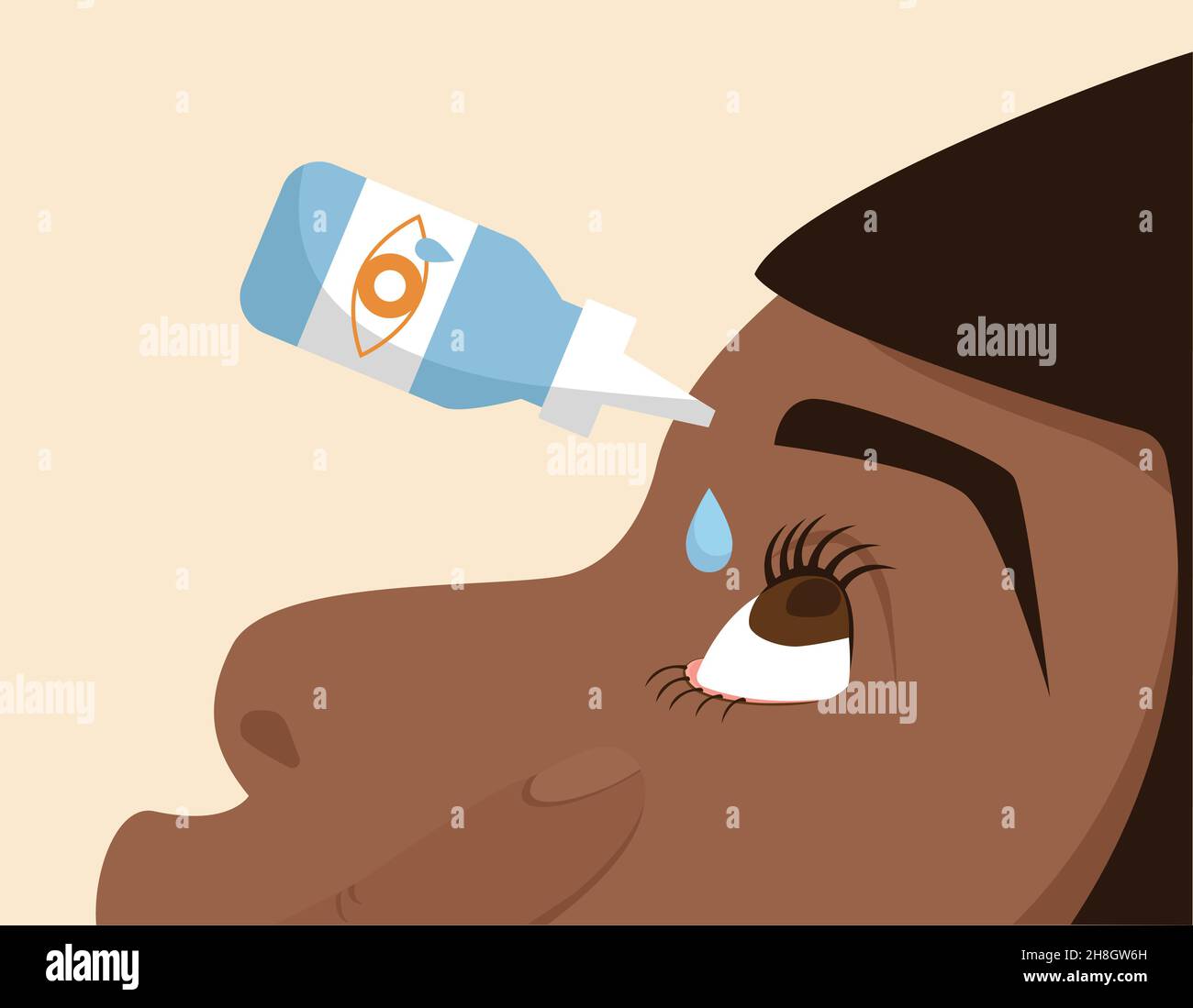 Person applying eyedrops. Medical treatment, pharmacy, irritaion. Can ...