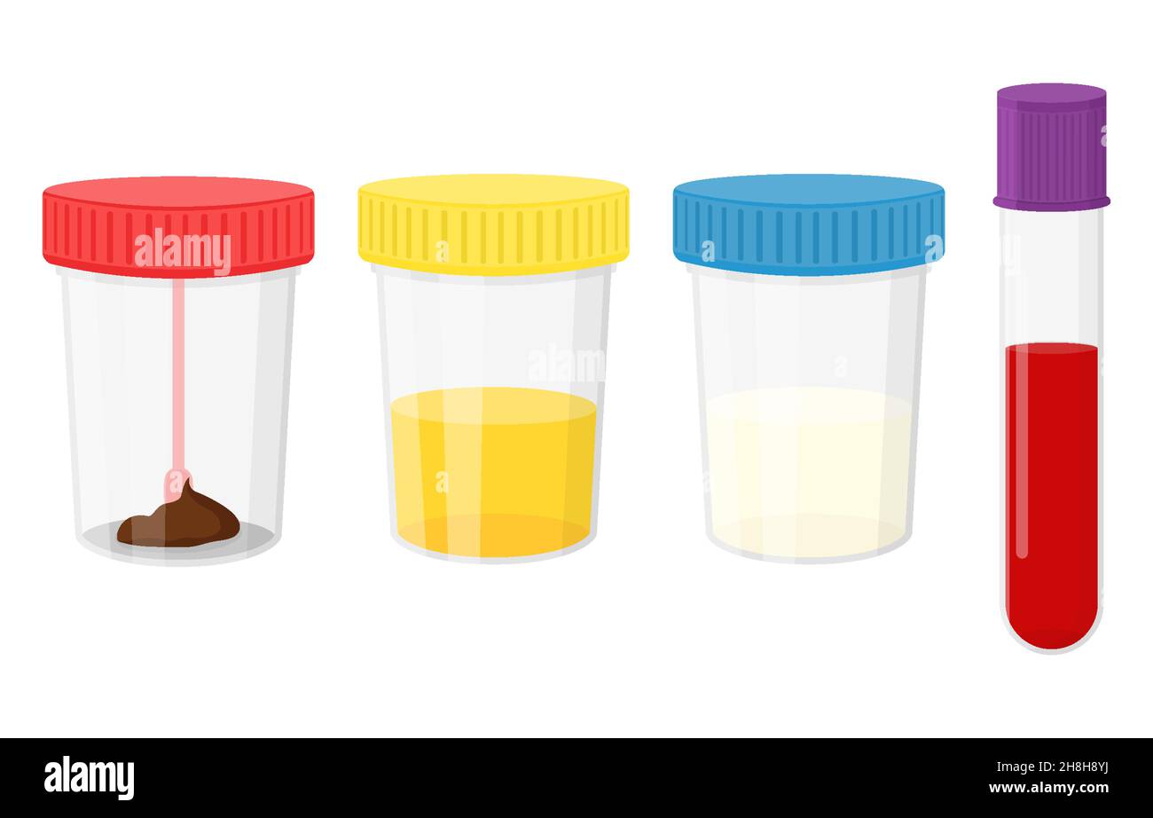 Laboratory tests. Test urine, feces, semen, and blood in plastic jars ...