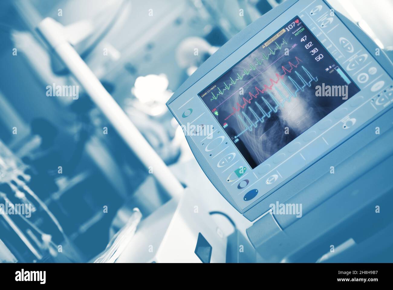 ECG waves and roentgen image of chest on the life support monitor ...