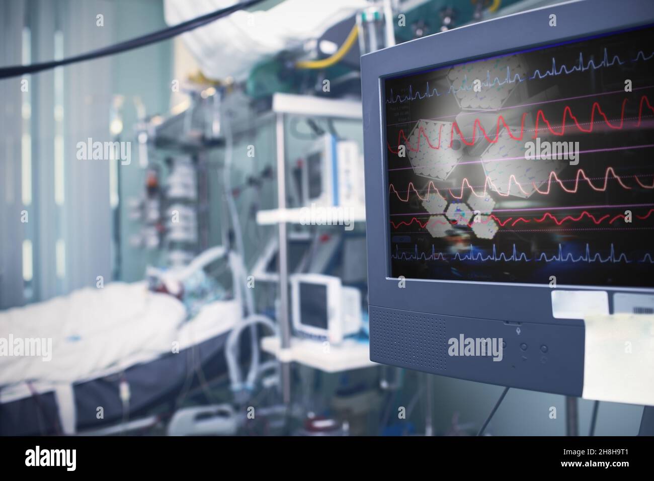 Severe surgery hi-res stock photography and images - Alamy
