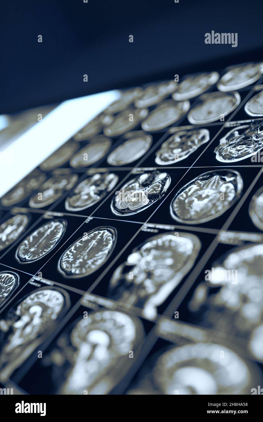 Doctors analyze patient mri scan hi-res stock photography and images ...
