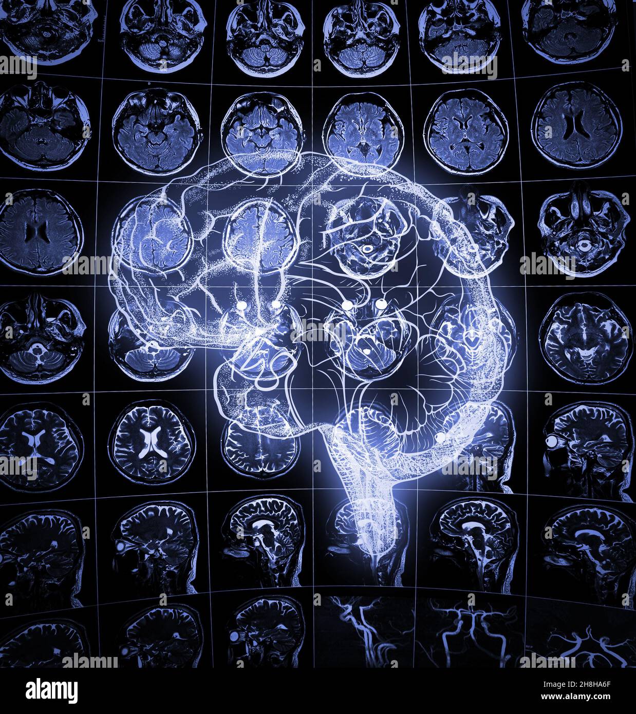 Luminous drawing of human brain on the background of human head scan ...