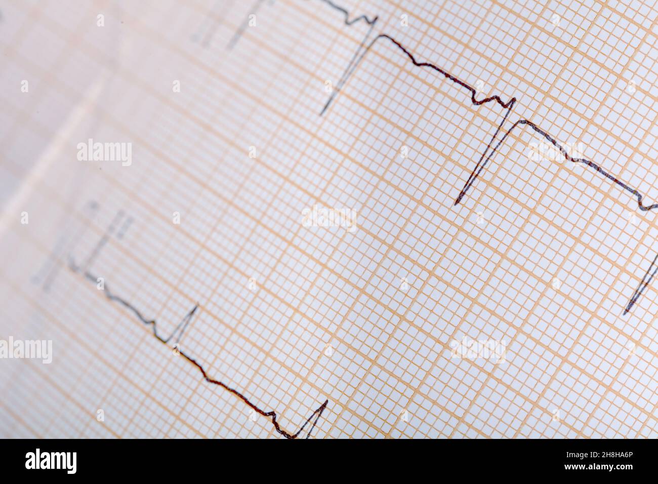 Medical background for design with ECG trace Stock Photo - Alamy
