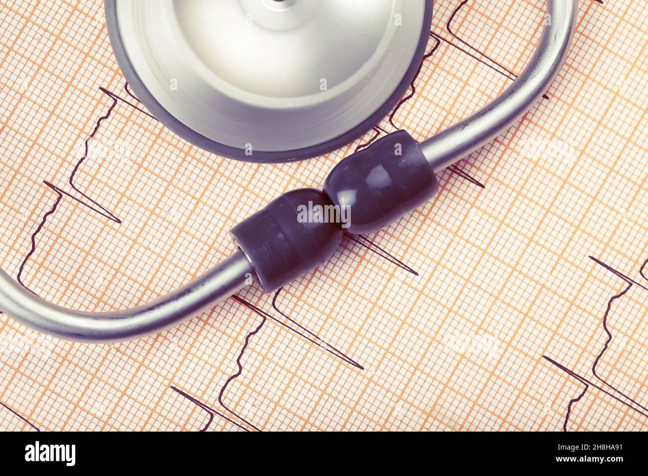 Stethoscope on the ECG chart, medical concept of early diagnostics of ...
