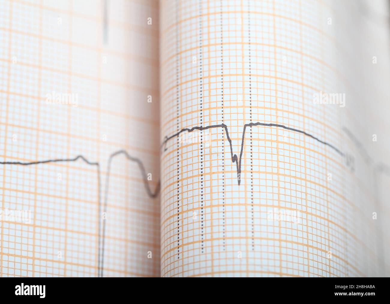 ECG graph paper as a health background with space for your insertion ...