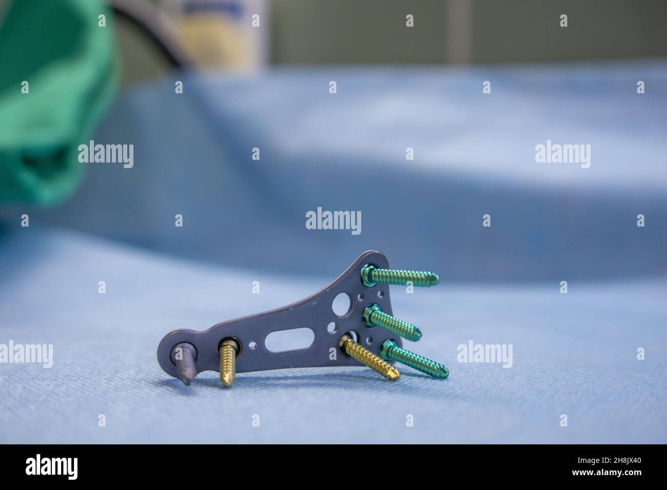 Radius fracture plate hi-res stock photography and images - Alamy