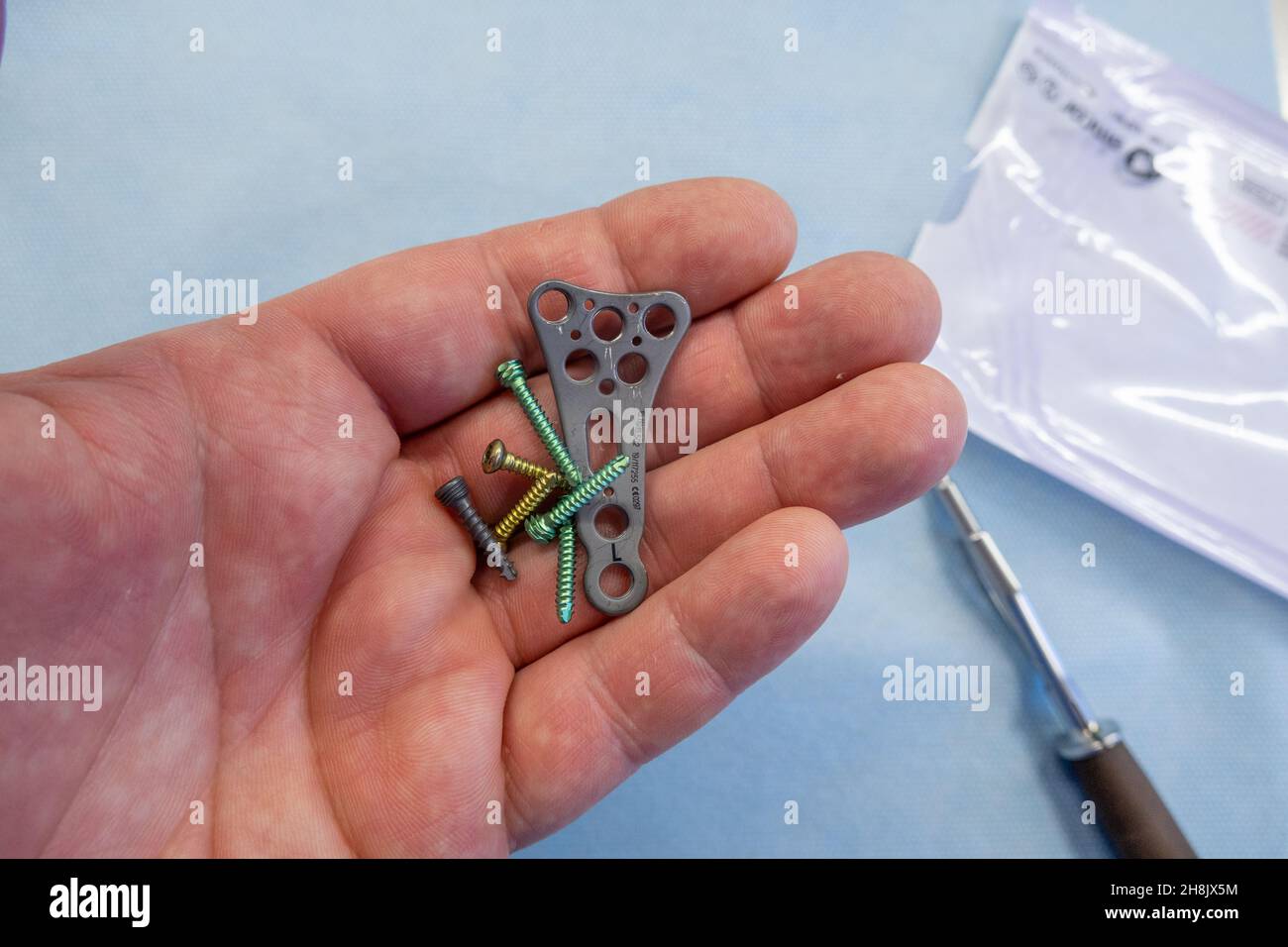 an explanted titanium plate and various titanium screws of a radius ...