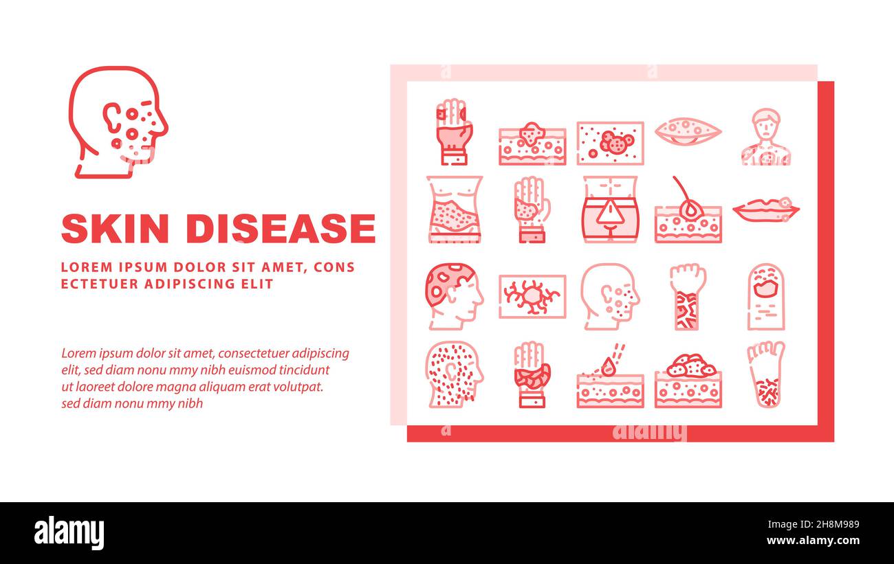 Skin Disease Human Health Problem Landing Header Vector Stock Vector