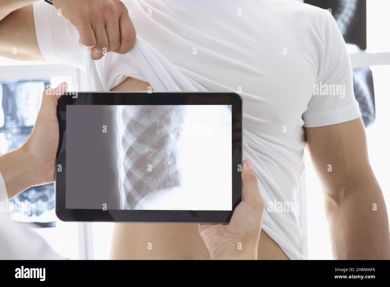 Medical worker put tablet device on patients body part and see ribs ...