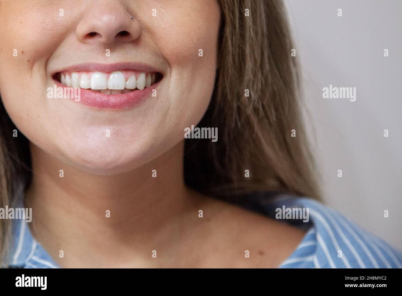Little girl smiling. Perfect smile. Smile without a device. Smile that ...