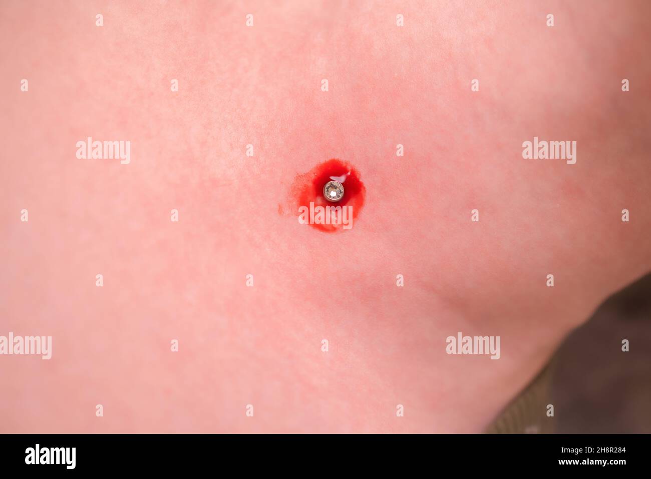 Sternum Piercing Scar