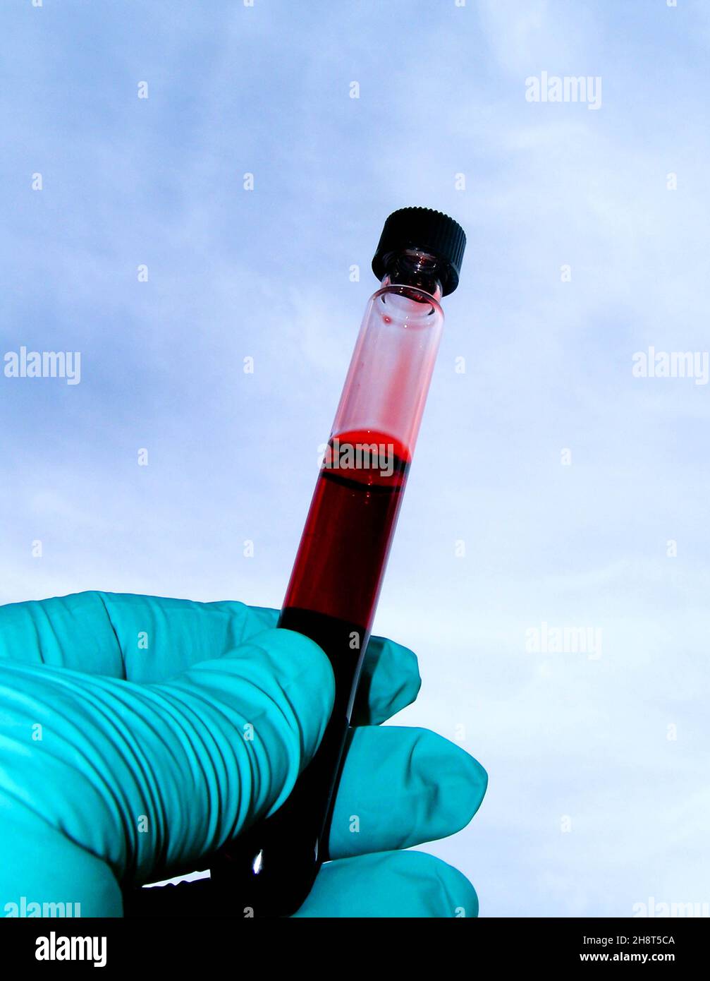 Plasma serum tube hi-res stock photography and images - Alamy