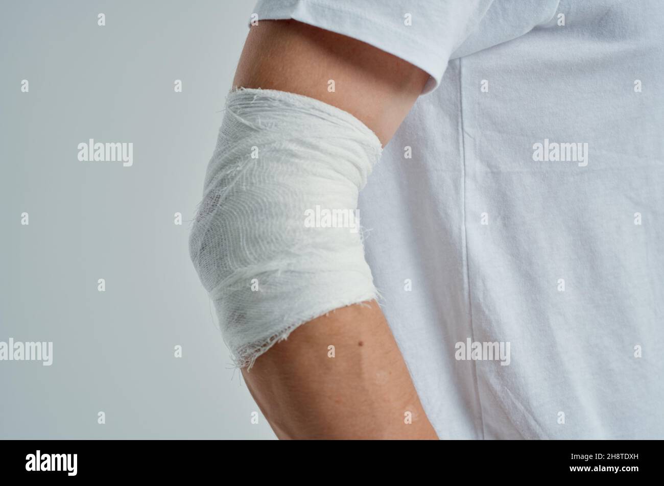 male patient bandaged hand injury to fingers hospital medicine Stock ...