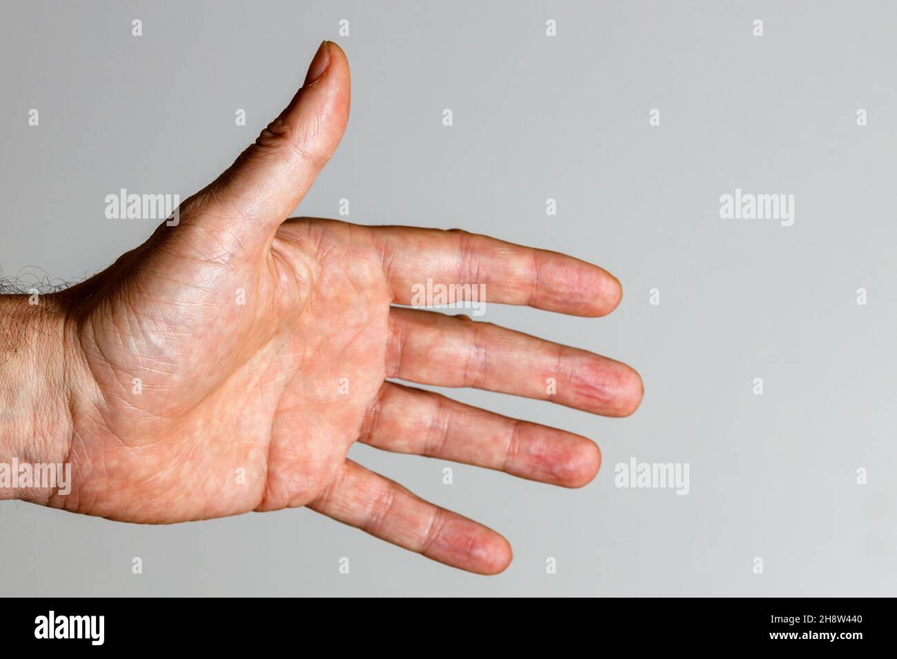 5 finger hand hi-res stock photography and images - Alamy