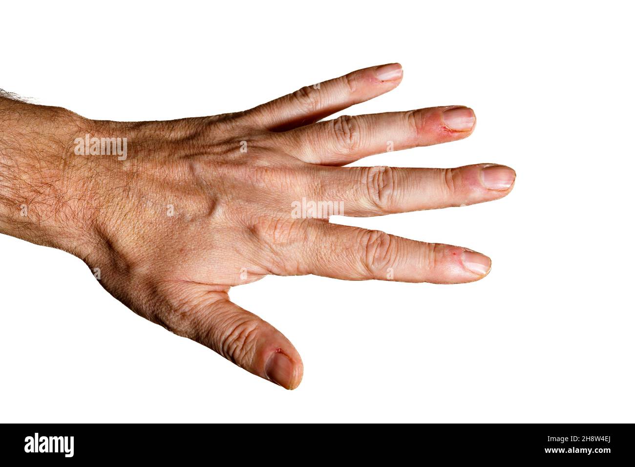 A hand with 5 finger Stock Photo - Alamy
