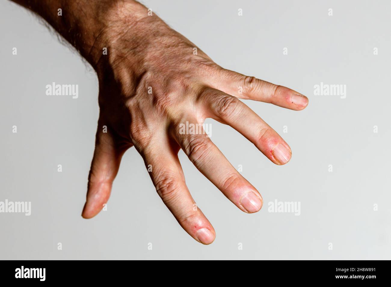 A hand with 5 finger Stock Photo - Alamy