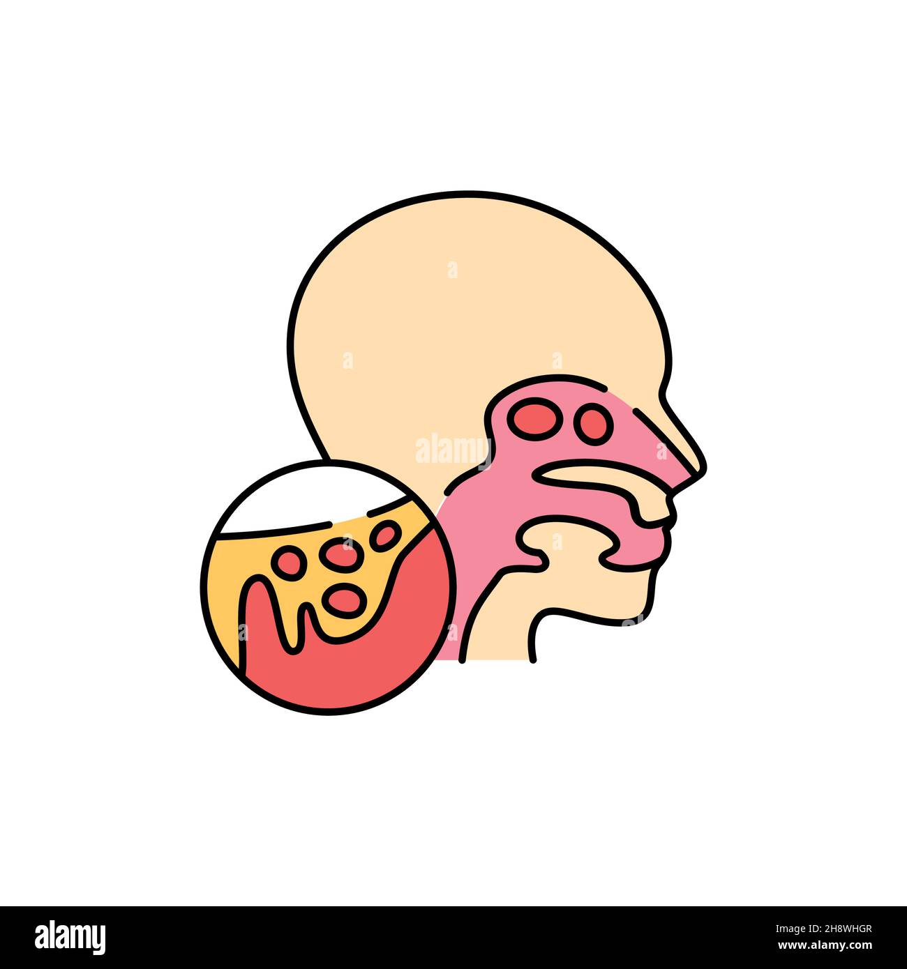 Sinusitis color line icon. Human diseases. Pictogram for web page ...
