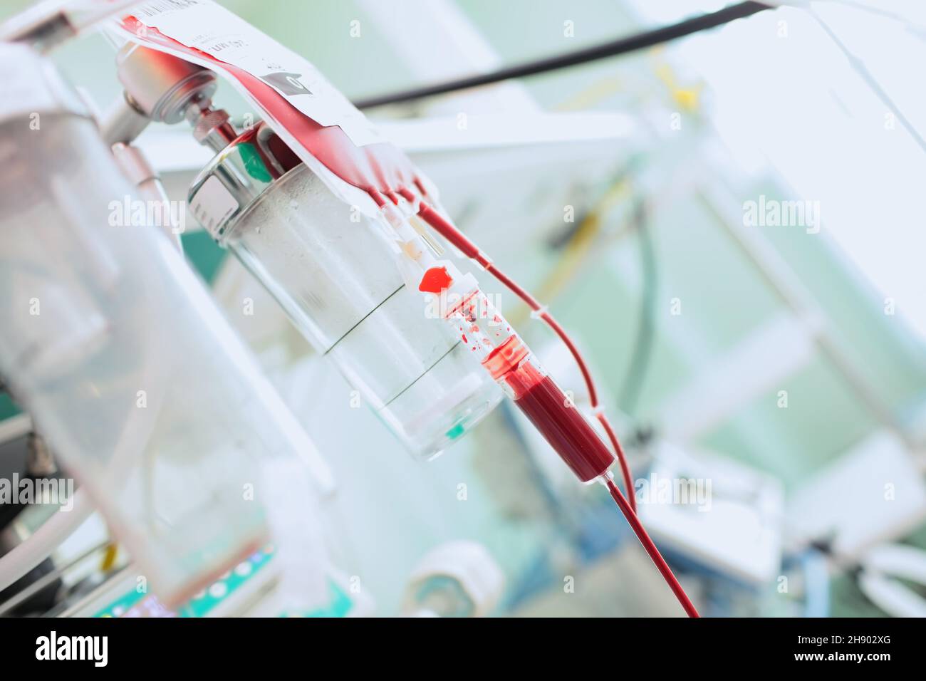 Blood bag hanging on the tripod during blood transfusion therapy in the ...