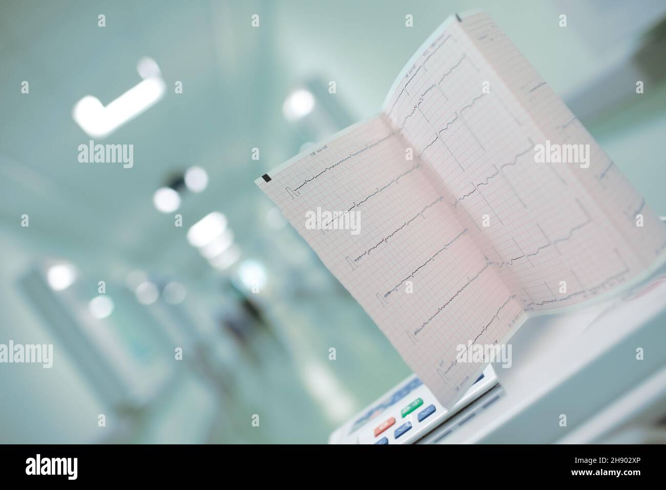 Bended cardiogram chart against the blurred hospital hall, concept of ...