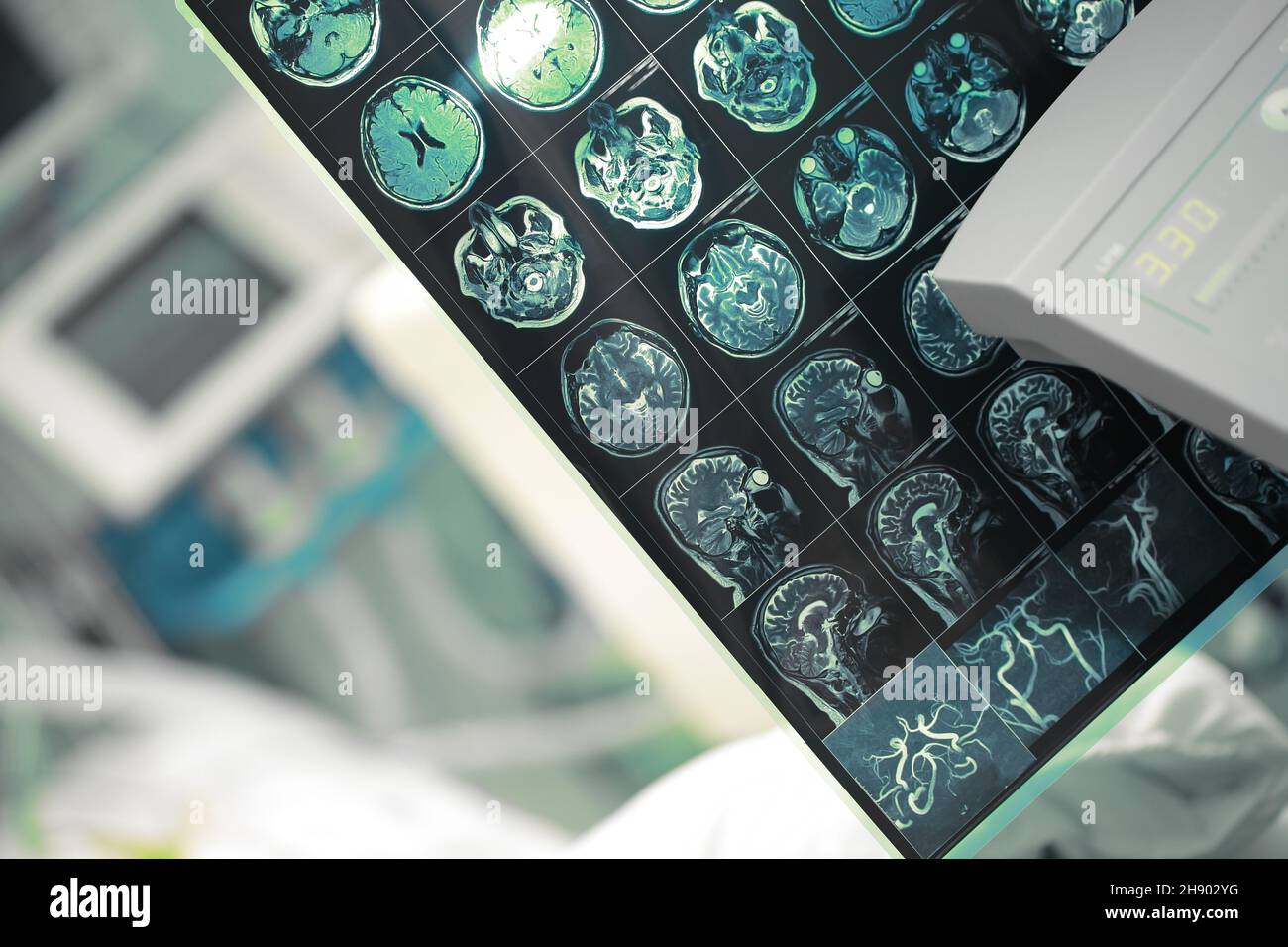 MRI of human head on the background of hospital equipment Stock Photo ...