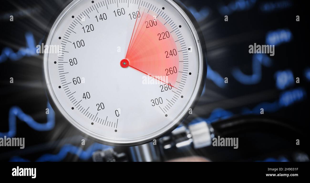 High blood pressure line hi-res stock photography and images - Alamy