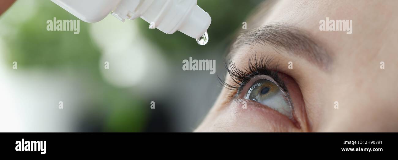 Woman dripping into her eyes with antibacterial drops closeup Stock ...