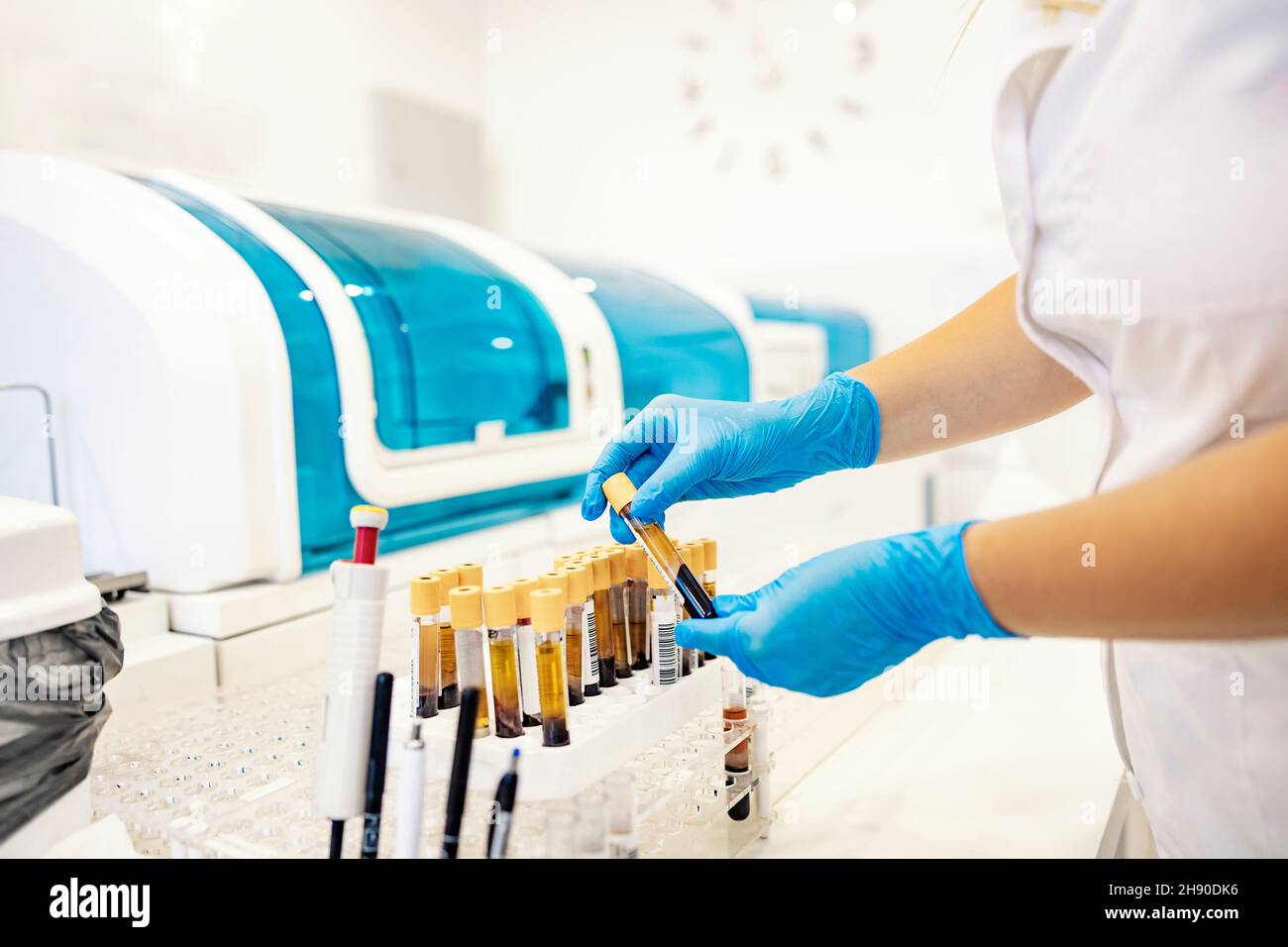 A test tubes with blood samples. A nurse standing in a laboratory and ...
