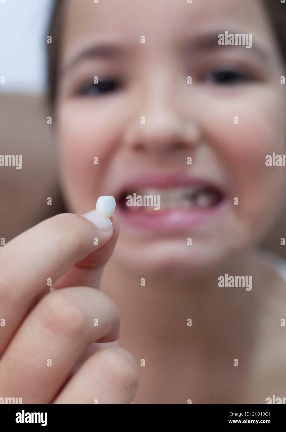 Little girl with front teeth missing hi-res stock photography and ...