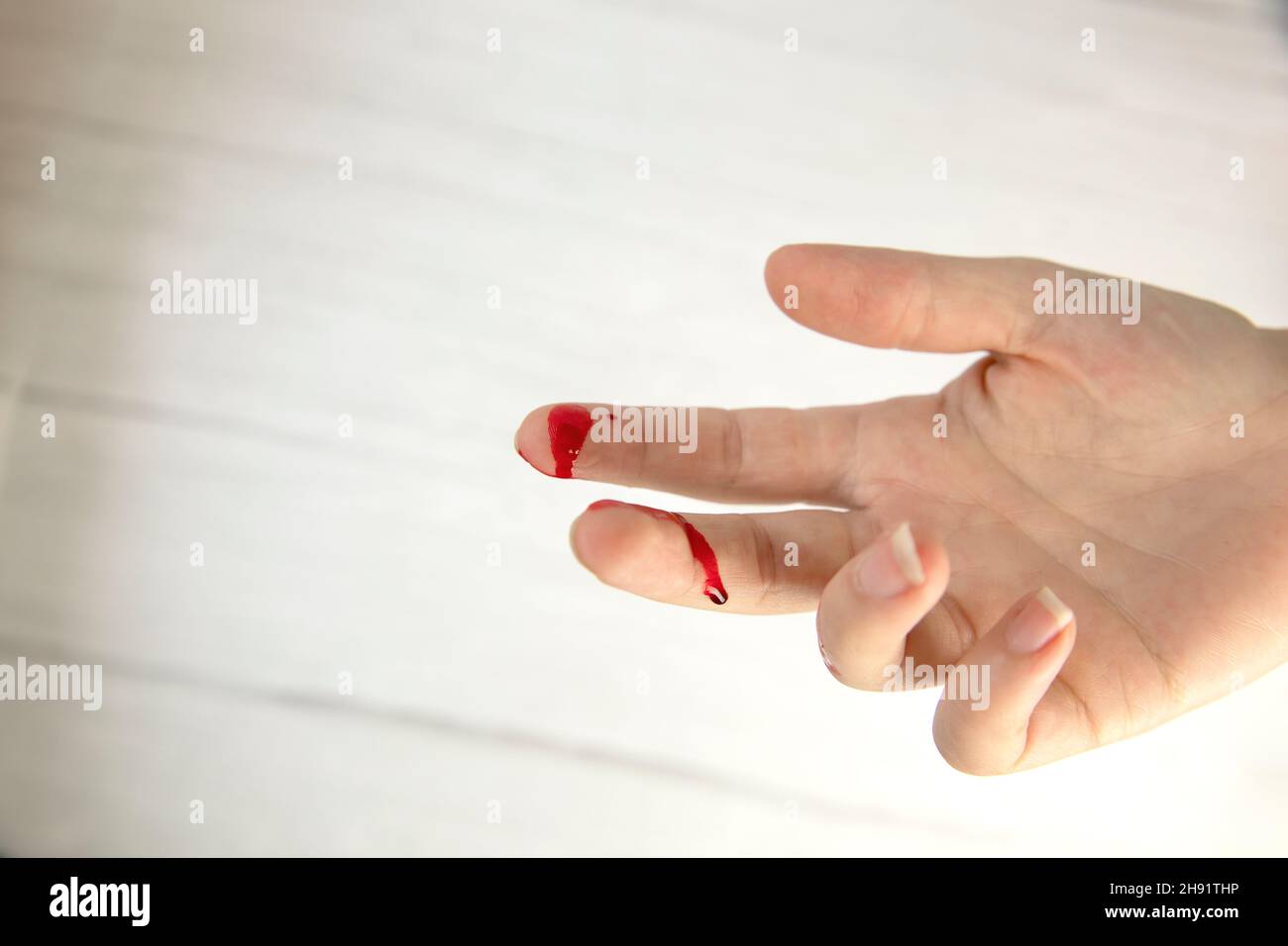 hand injury with blood, blood wound cut top view, copy space, medical ...