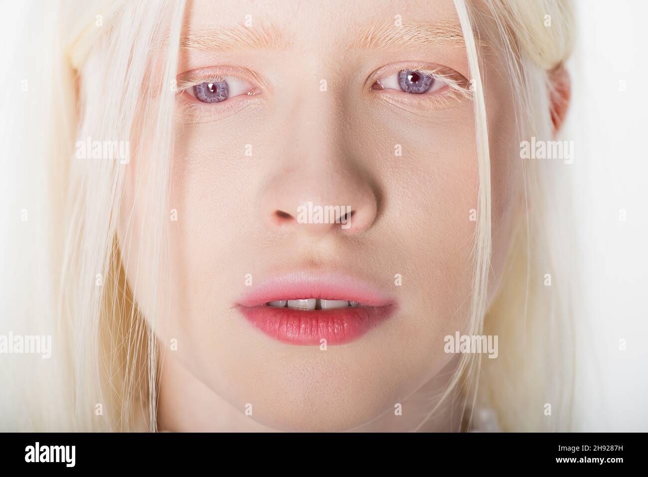 Portrait of young albino woman looking away isolated on white Stock ...