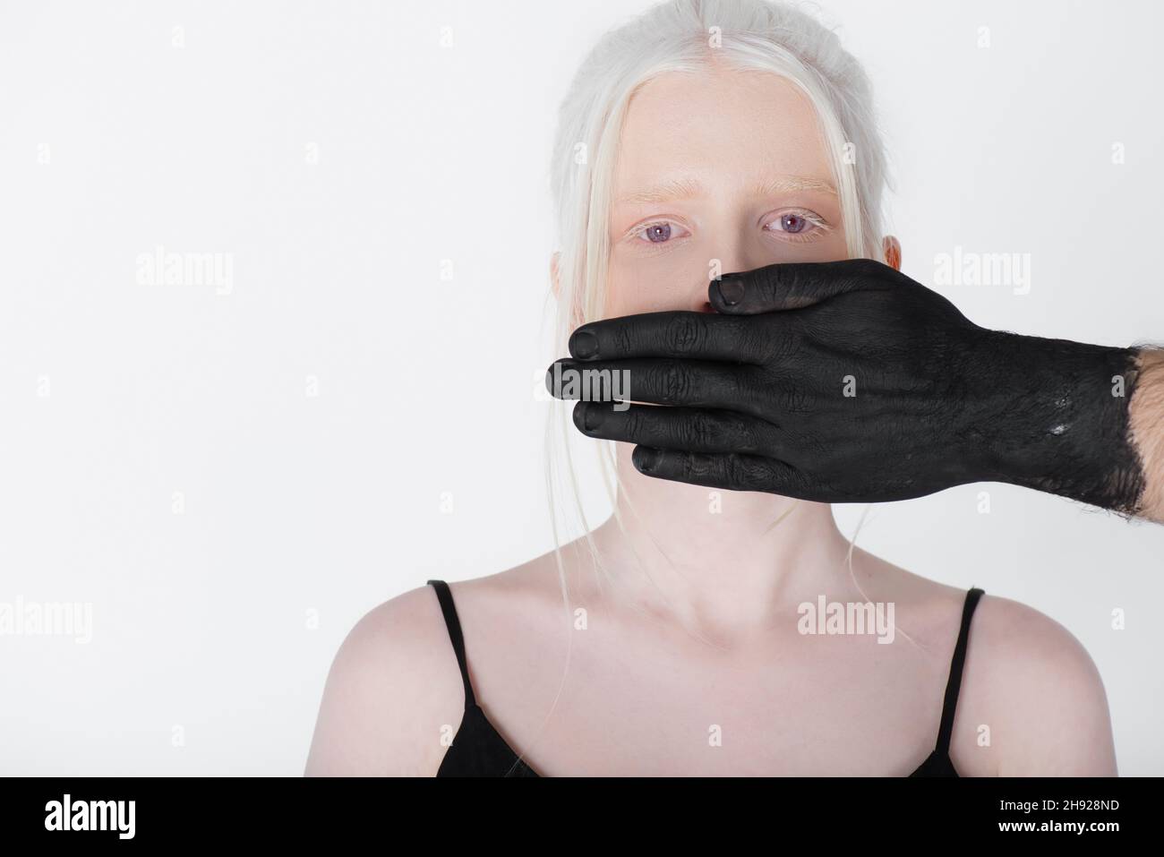 Albino model male hi-res stock photography and images - Alamy