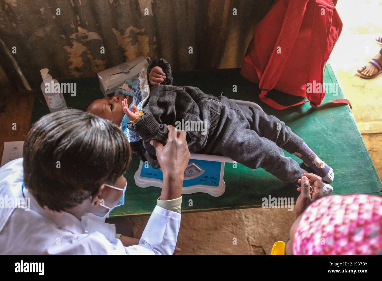 Abnormal baby hi-res stock photography and images - Alamy