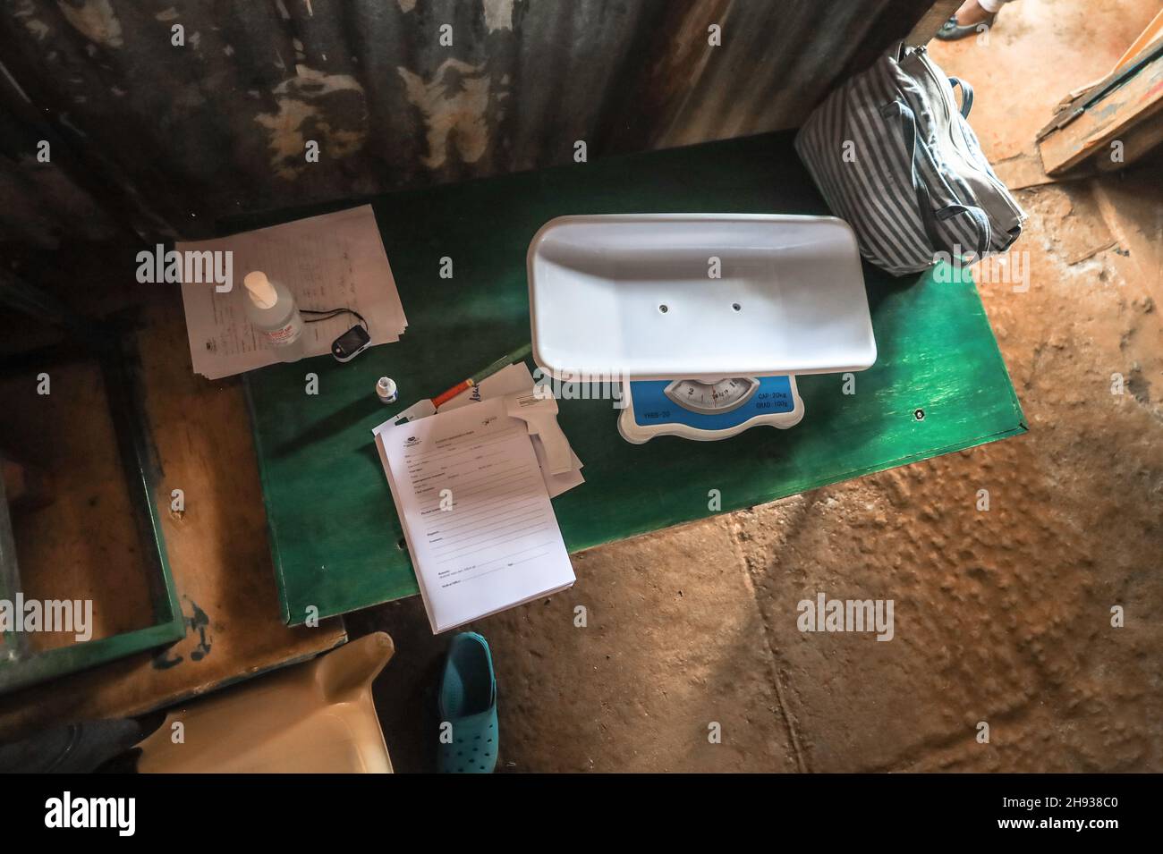 Abnormal baby hi-res stock photography and images - Alamy