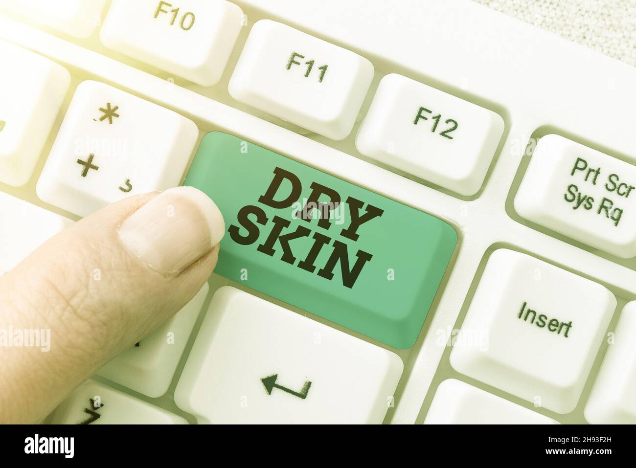 Sign displaying Dry Skin. Business overview uncomfortable condition ...