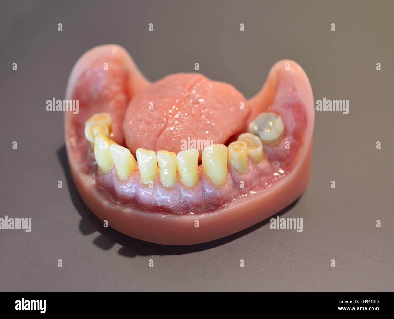 Stomatology teeth models dental education model with denture Stock ...