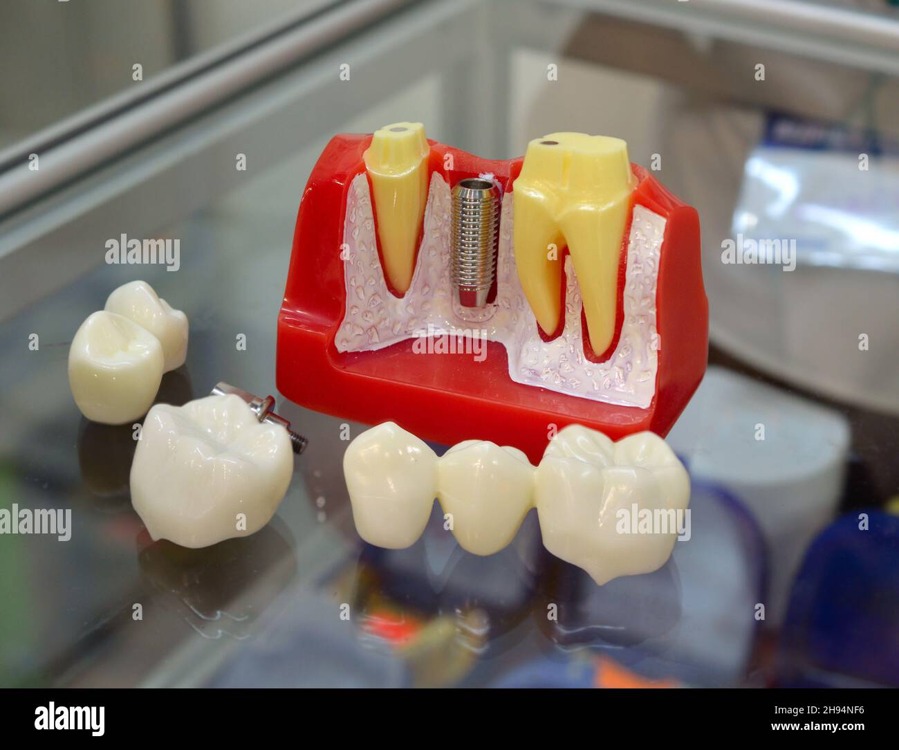 Stomatology teeth models dental education model with denture Stock ...