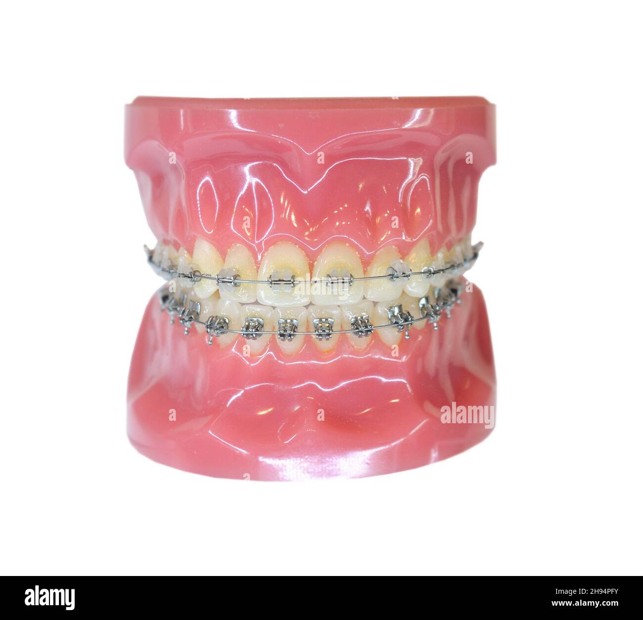 Orthodontic teeth models dental education model jaws with half ceramic ...