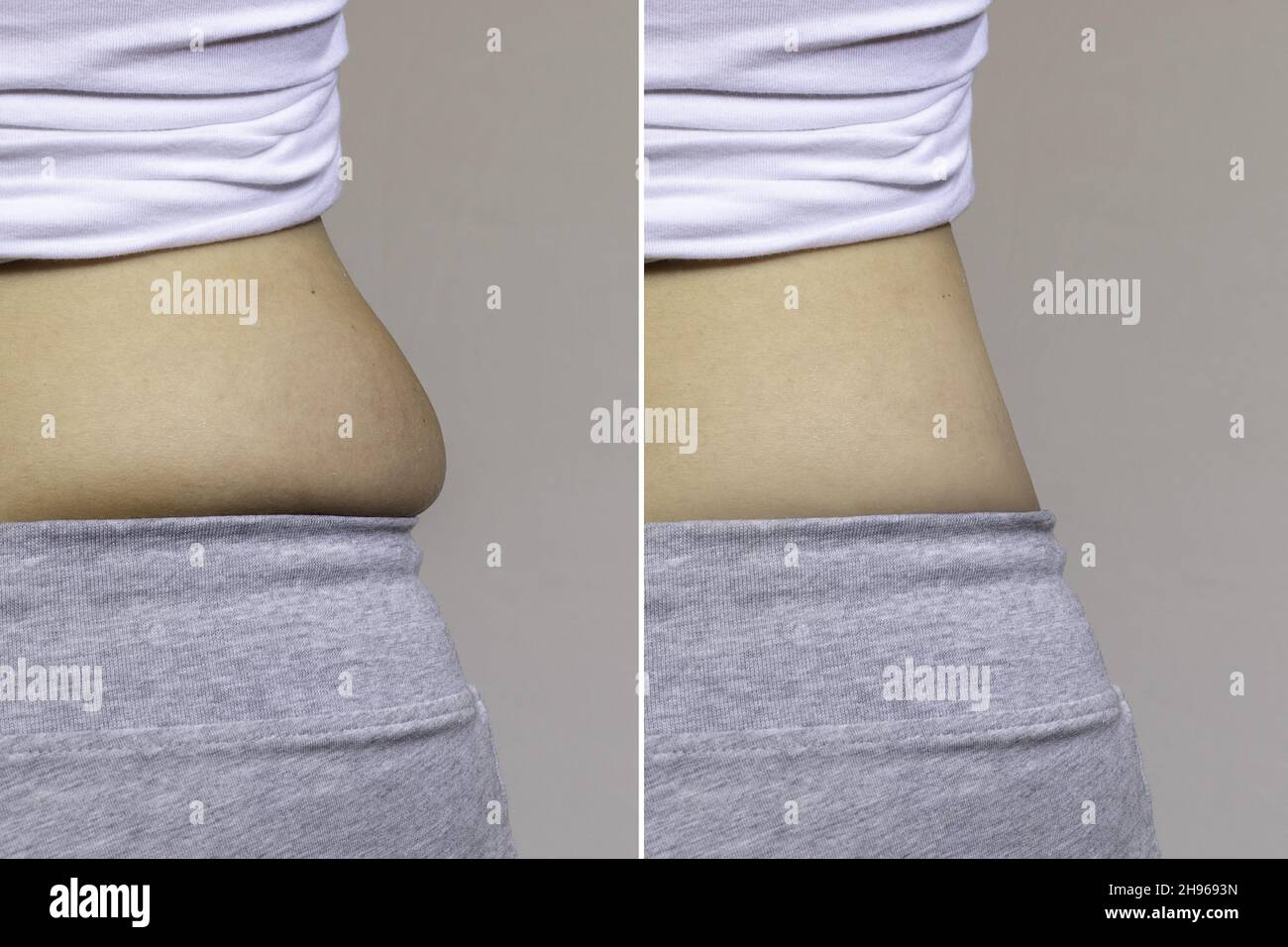 Slim and fat side belly comparison of a woman Stock Photo - Alamy