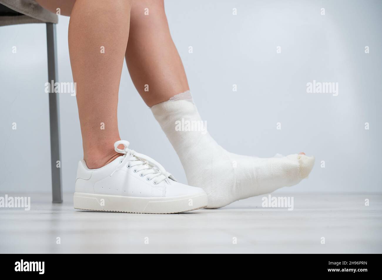 Plaster Legs High Resolution Stock Photography and Images - Alamy